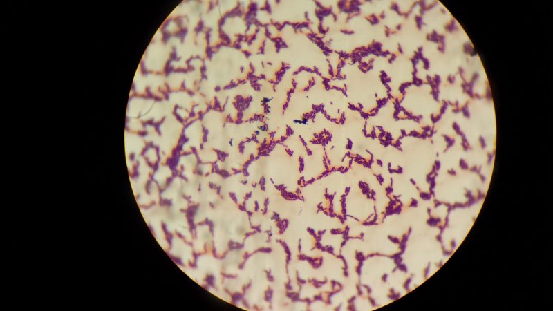 La halicina se convierte el primer antibiótico contra las ...